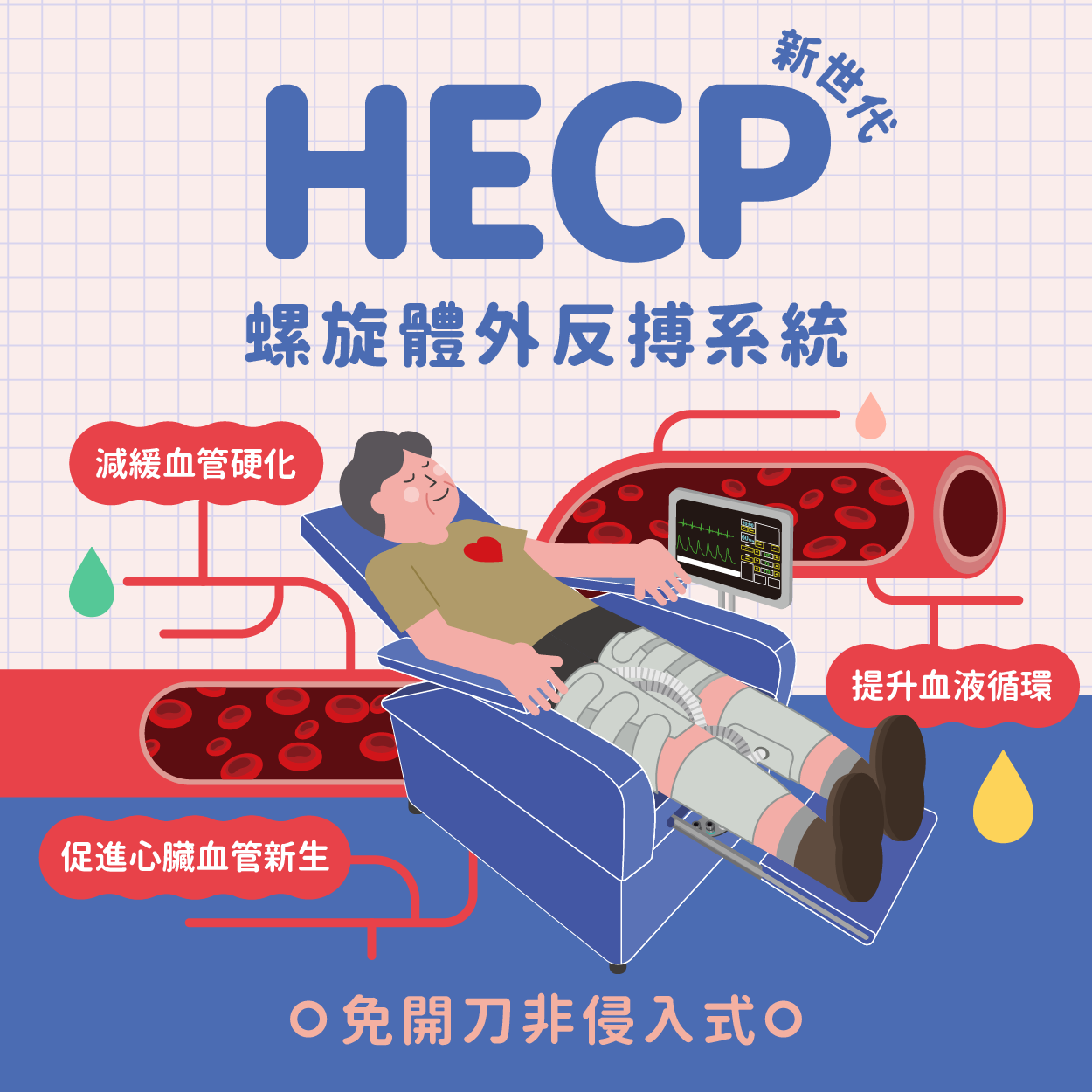 體外反搏系統HECP專題