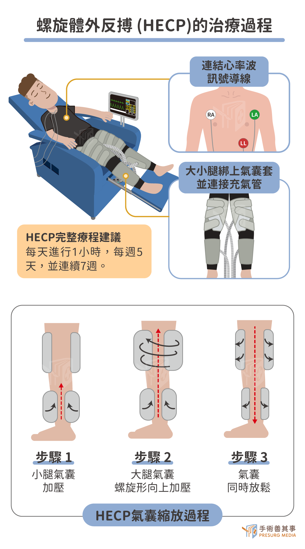 血管硬化怎麼辦？新世代體外反搏系統HECP提升血液循環